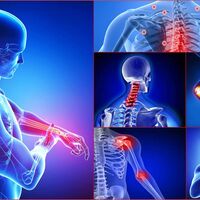 Artróza nebo artritida? | MUDr. Picek, ortoped, traumatolog operatér